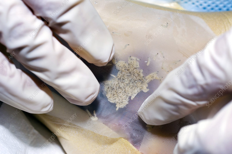 lucilia sericata and maggot therapy